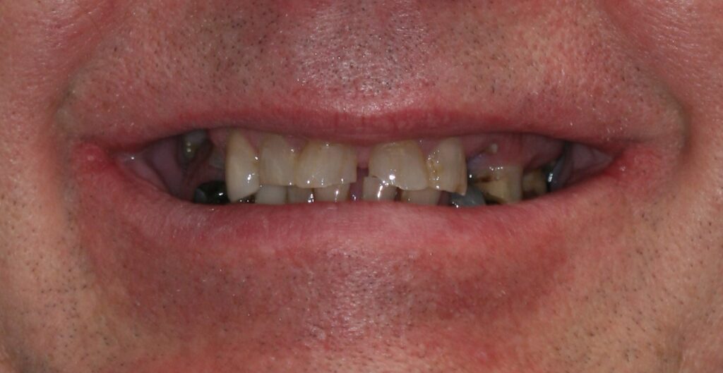 View Our Smile Gallery in Katy